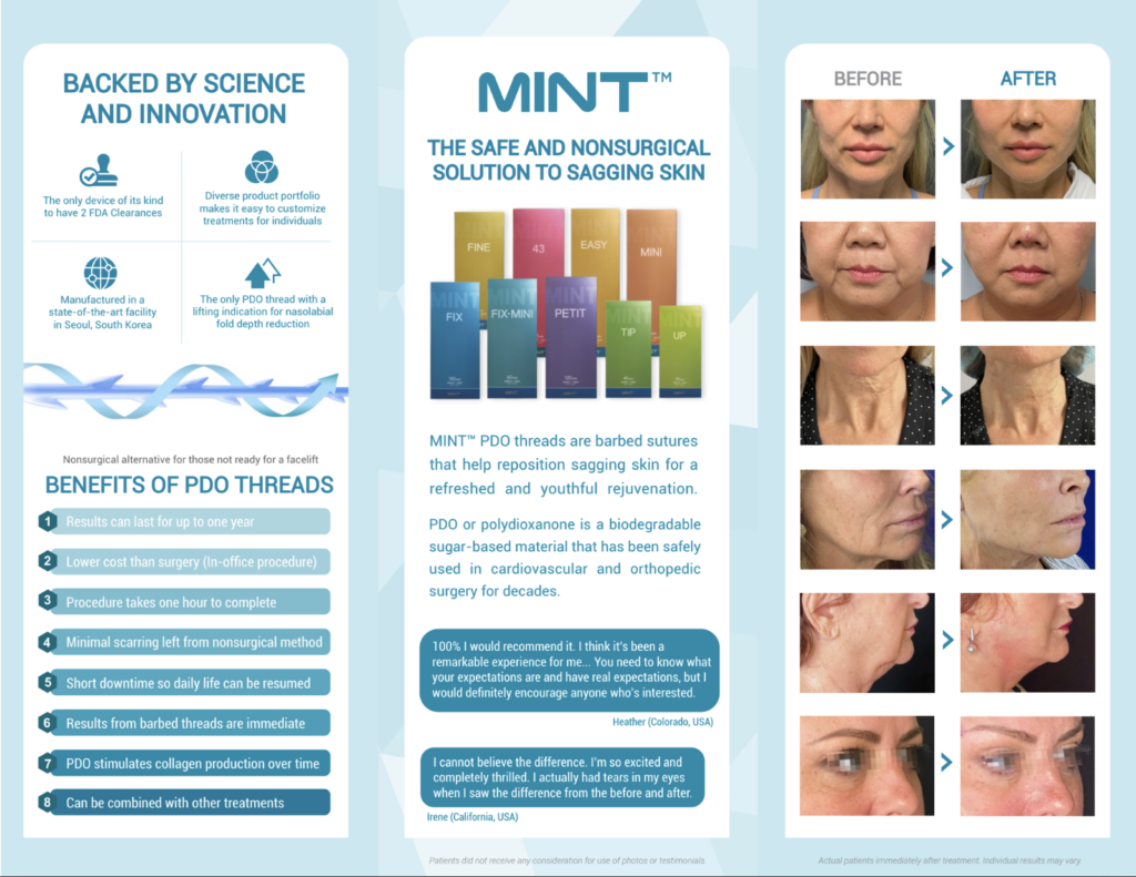 Mint PDO Thread - Phi MD